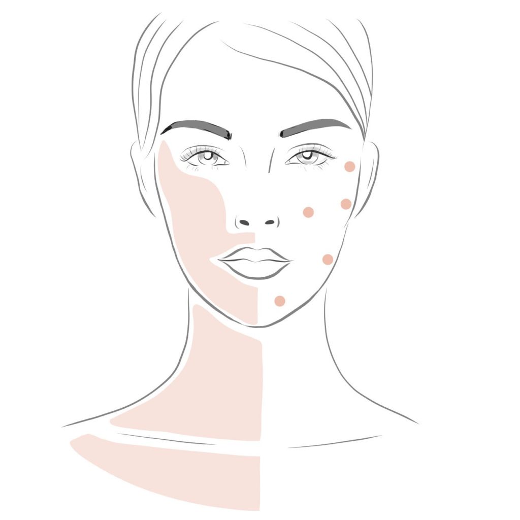 Injectable Moisturizers - Dr Eva Jablonka | Aesthetic Medicine